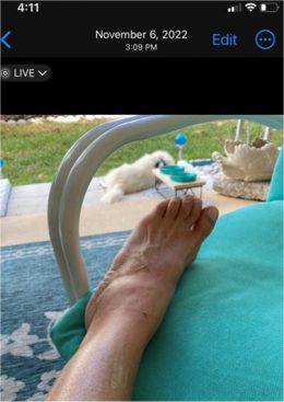 ‘Lyme’ Articles at RIFE MACHINE BLOG -Testimonials